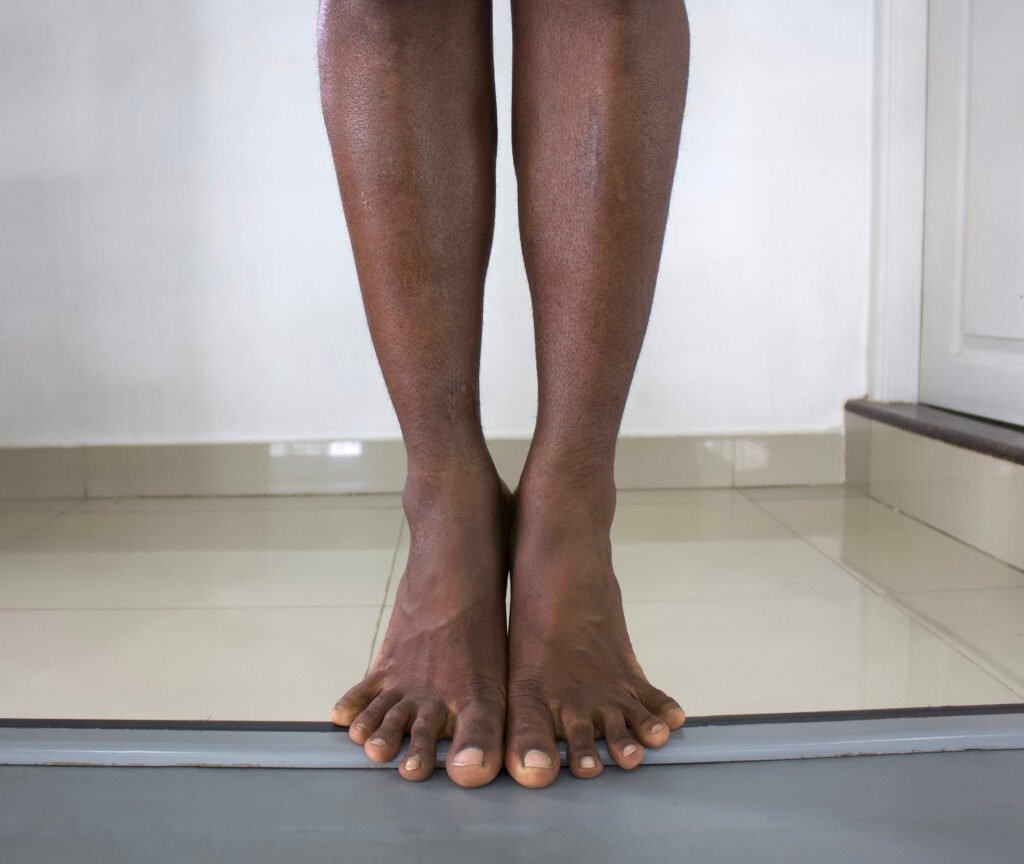 Foot Alignment - The Lewis Foundation of Classical Ballet (TLFCB)