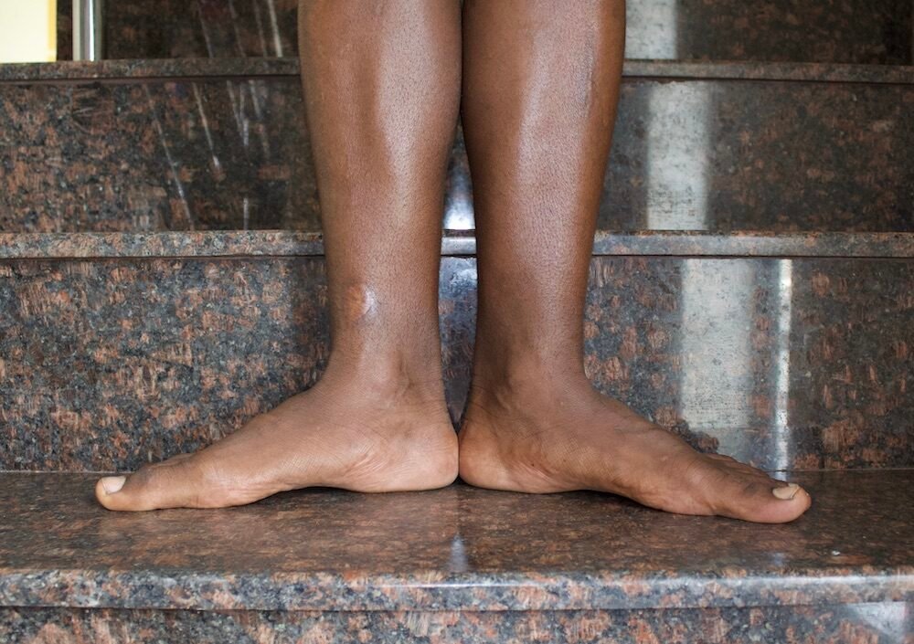 Foot Alignment - The Lewis Foundation of Classical Ballet (TLFCB)